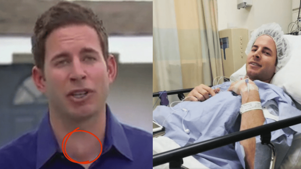 In a somber update, Tarek El Moussa's physician provided fresh ...